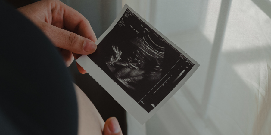 Understanding the Different Types of Ultrasound Paper Glossy, Standard