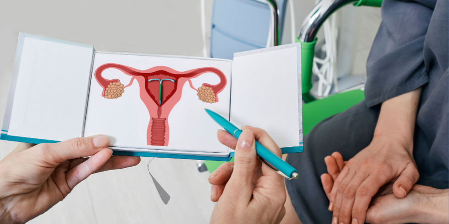Step-by-Step Guide to IUD Insertion and Removal