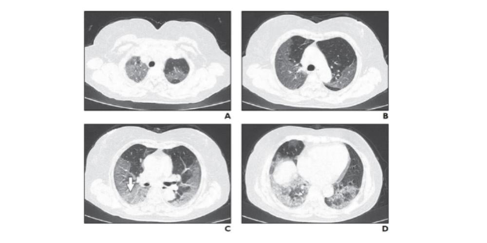 French medical imaging expert offers 6 tips to successfully treat COVI